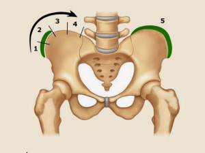The Risser sign, growth and scoliosis: let’s clear a few things up - ISICO